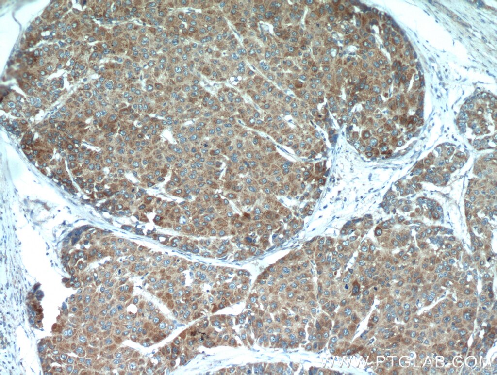 TFAM Antibody 19998-1-AP | Proteintech