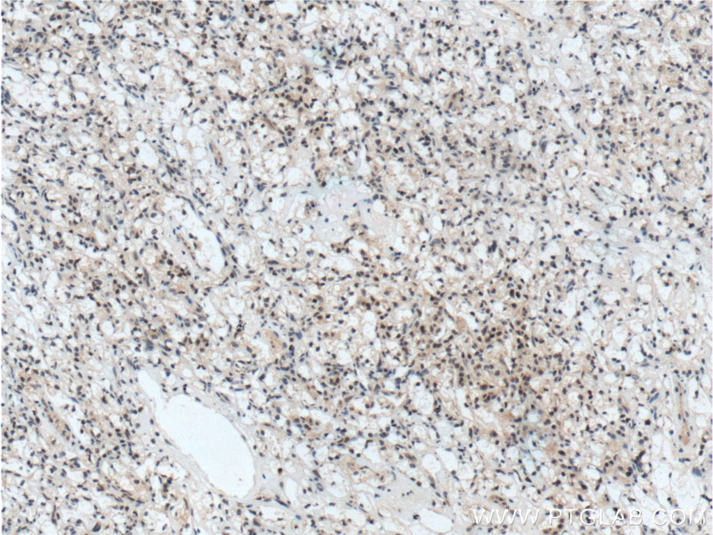 TFE3 antibody (14480-1-AP) | Proteintech