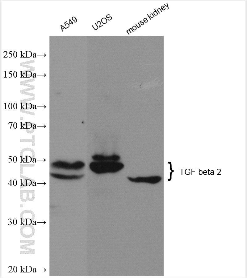 TGF beta 2 antibody (28426-1-AP) | Proteintech