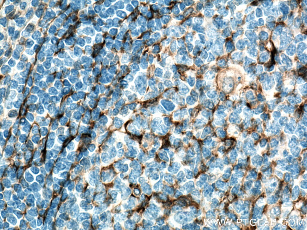 TMEM173/STING Antibody 19851-1-AP | Proteintech