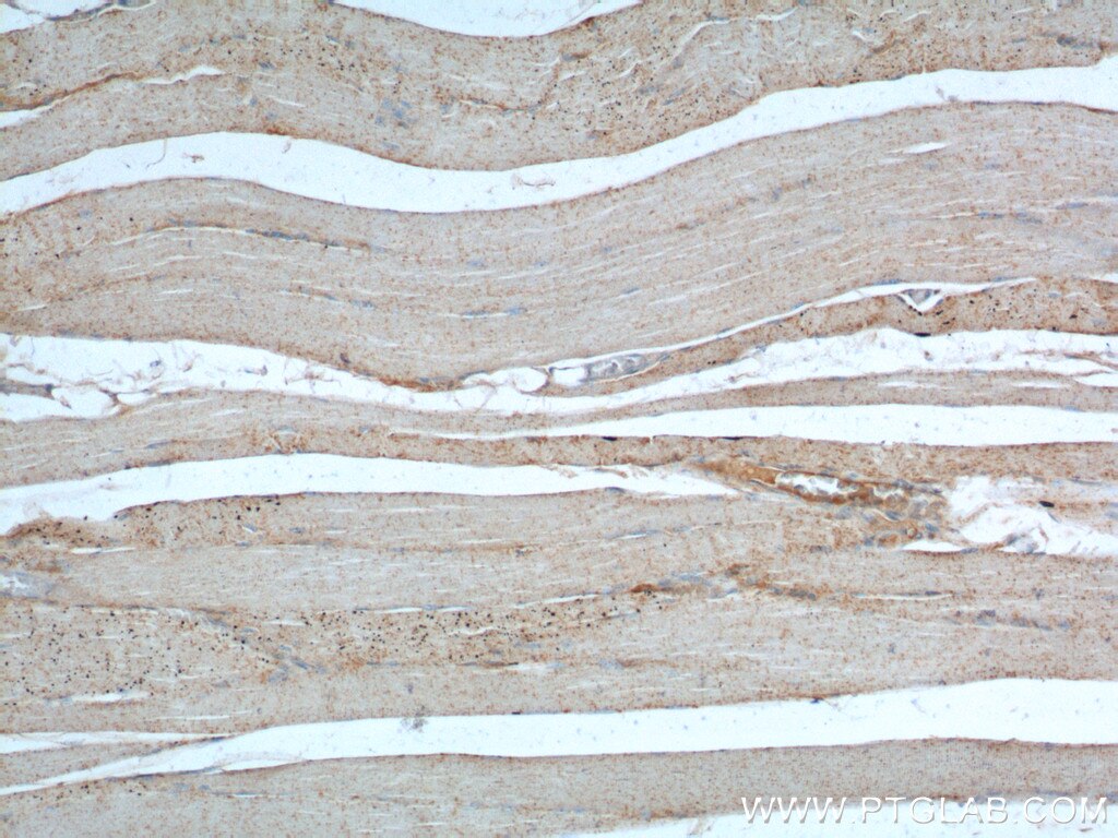 TNF alpha Antibody 26405-1-AP | Proteintech