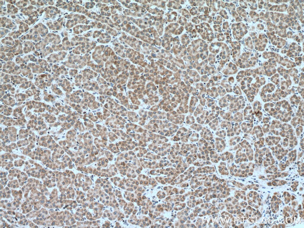 TOM20 Antibody 66777-1-Ig | Proteintech