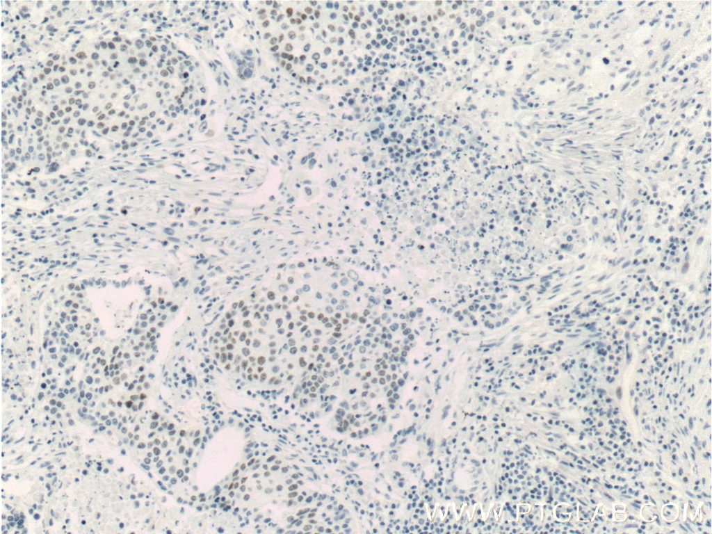 p63 Antibody 12143-1-AP | Proteintech