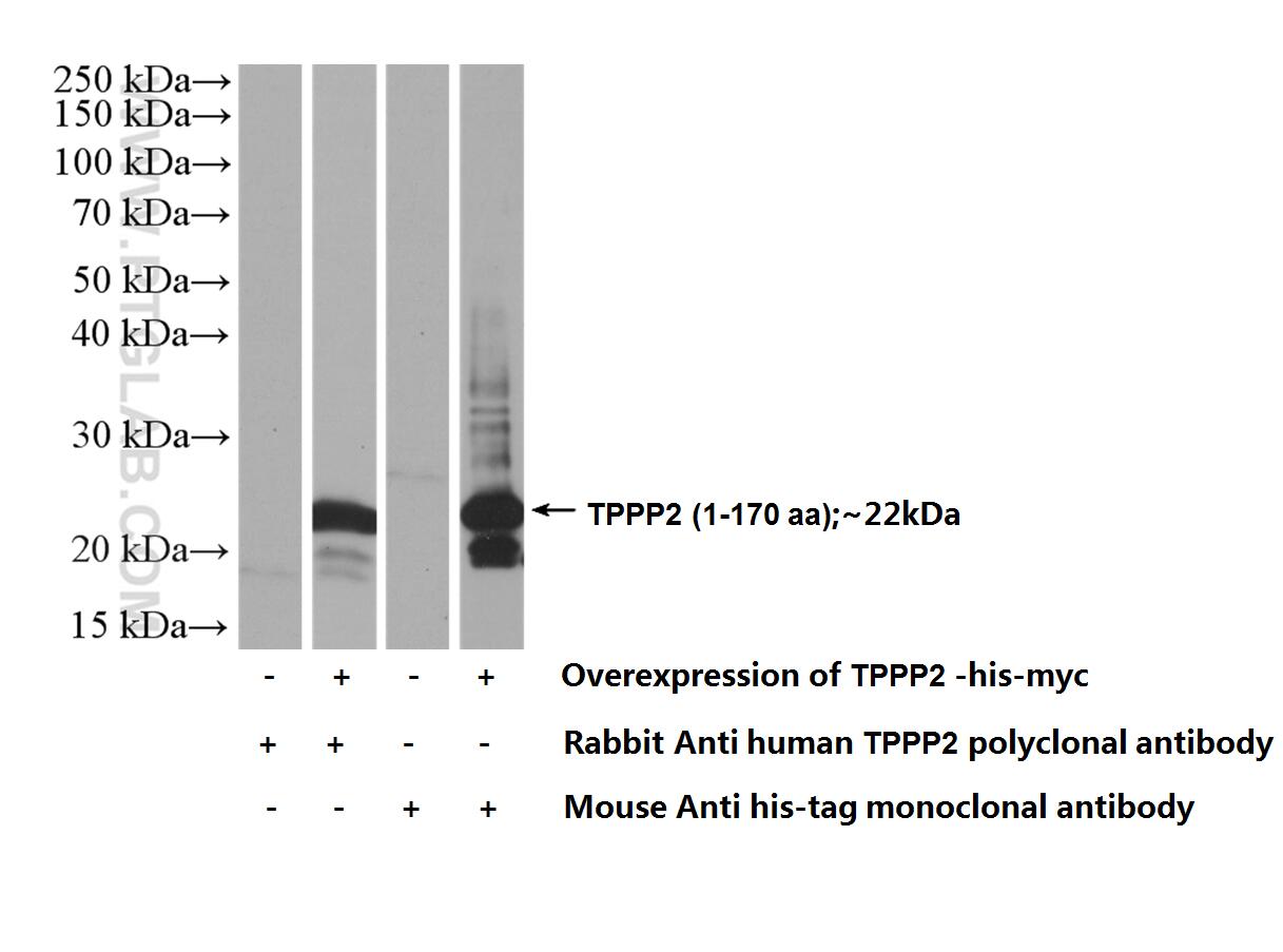 TPPP2 Antibody 13633-1-AP | Proteintech