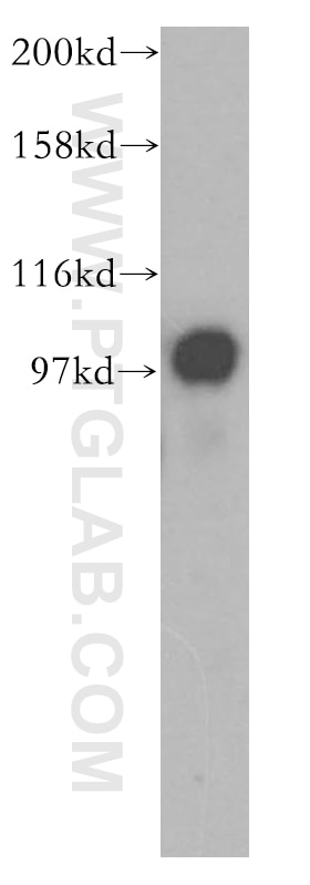 TPX2 Antibody 11741-1-AP | Proteintech