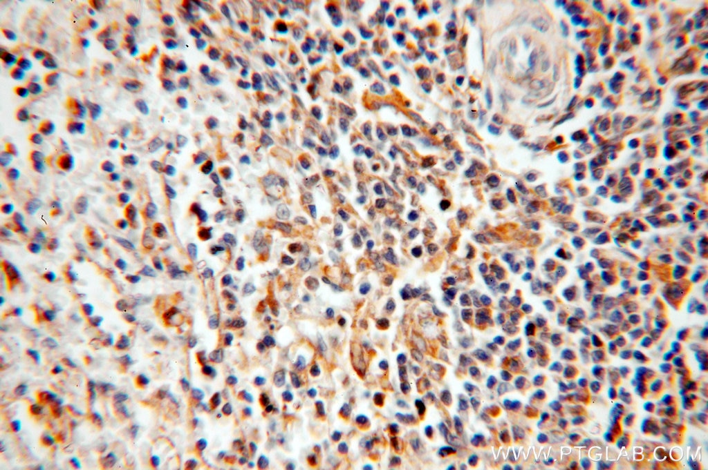 TSPAN7 antibody (18695-1-AP) | Proteintech