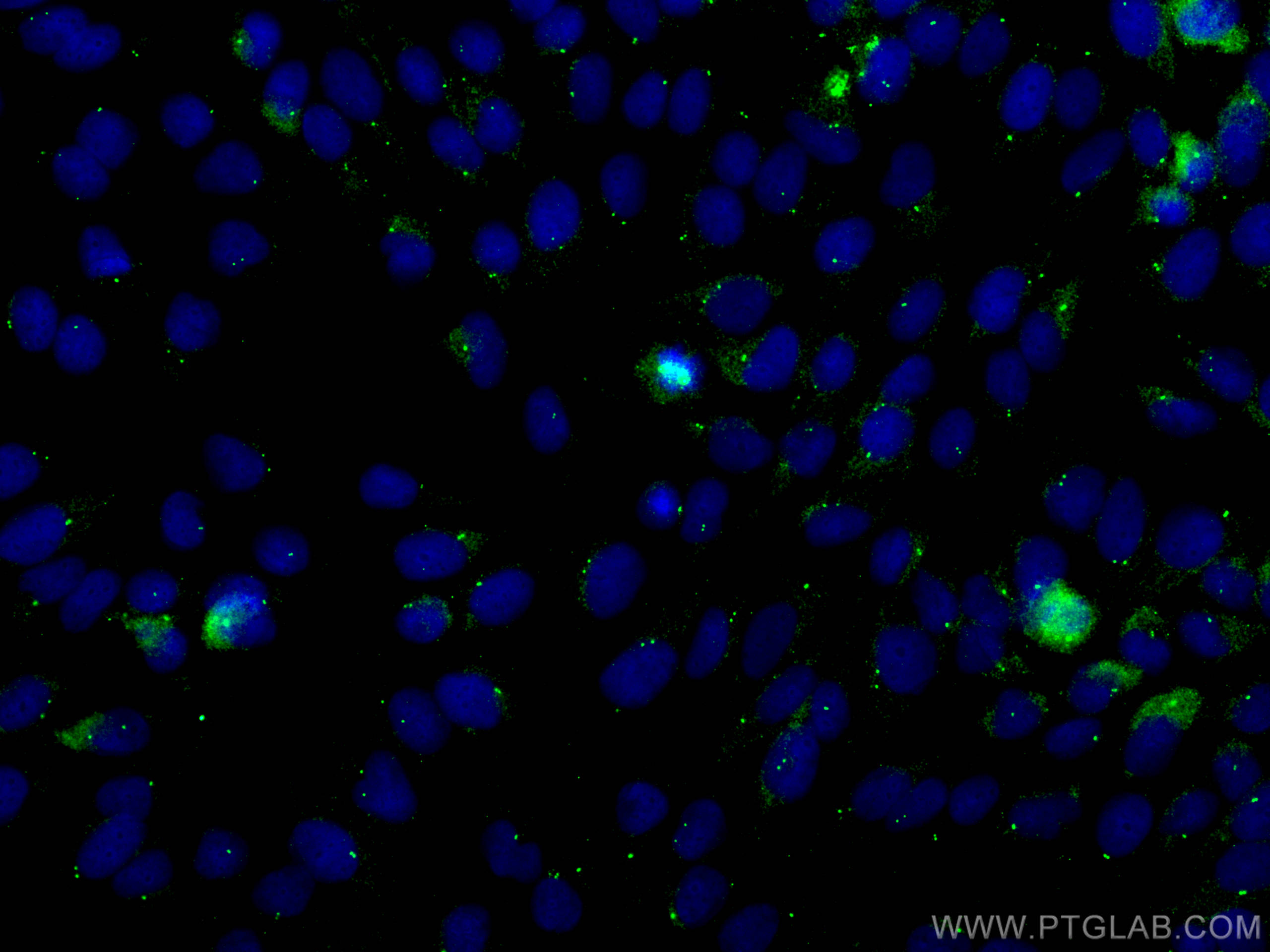 Gamma Tubulin antibody (15176-1-AP) | Proteintech