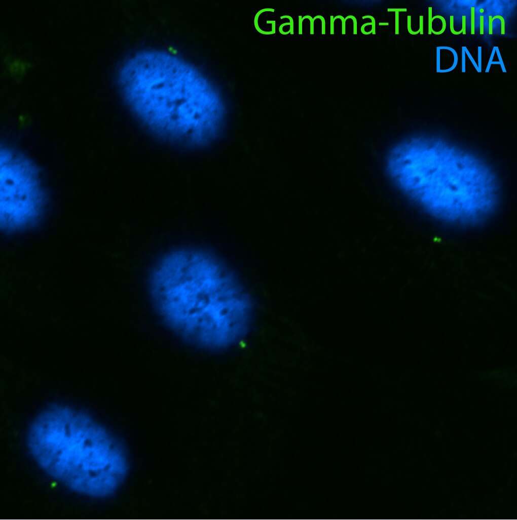 Gamma Tubulin antibody (15176-1-AP) | Proteintech