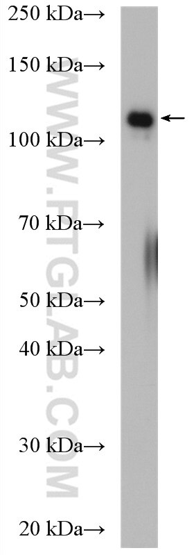 UBE4A antibody (21548-1-AP) | Proteintech