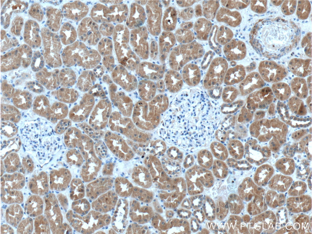 UROD antibody (15547-1-AP) | Proteintech