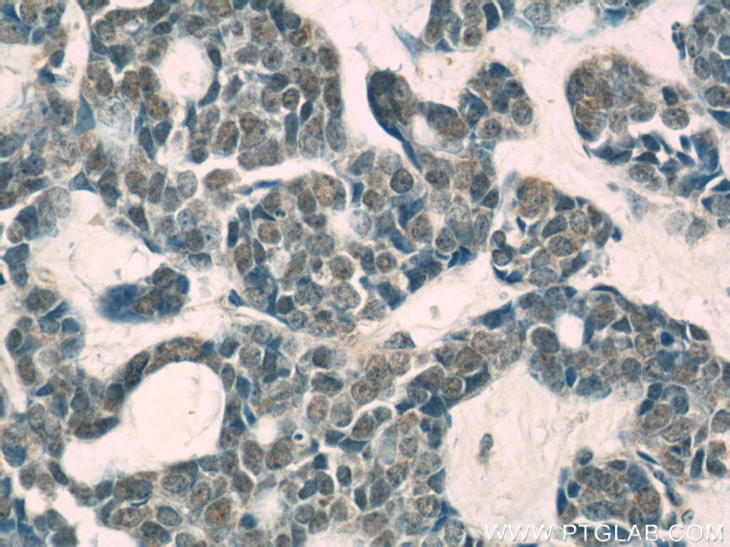 Usp1 Antibody 66069 1 Ig Proteintech