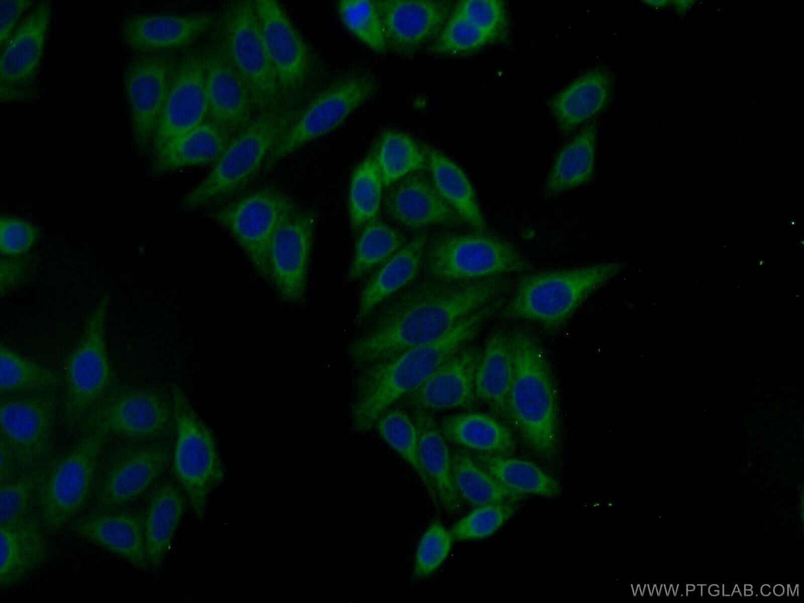 VAPA Antibody 15275-1-AP | Proteintech