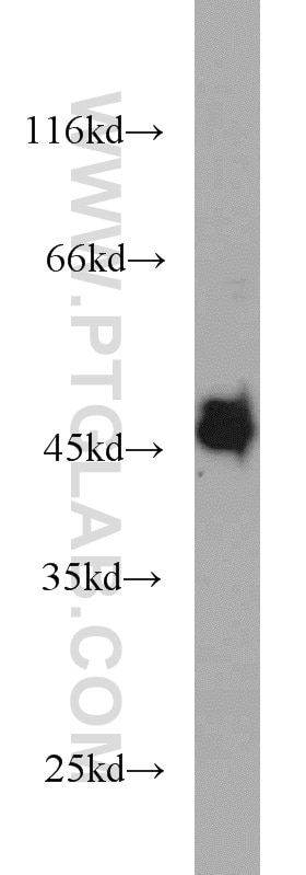 VASP antibody (13472-1-AP) | Proteintech