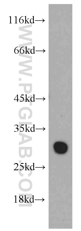 VDAC1/Porin antibody (66345-1-Ig) | Proteintech