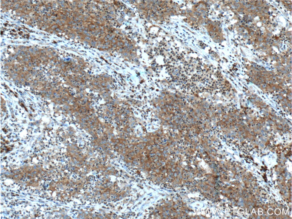 VEGF Antibody 19003-1-AP | Proteintech