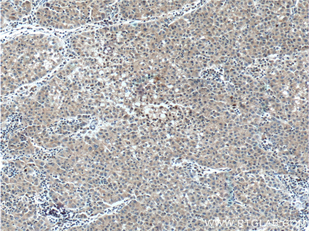 VEGF Antibody 19003-1-AP | Proteintech