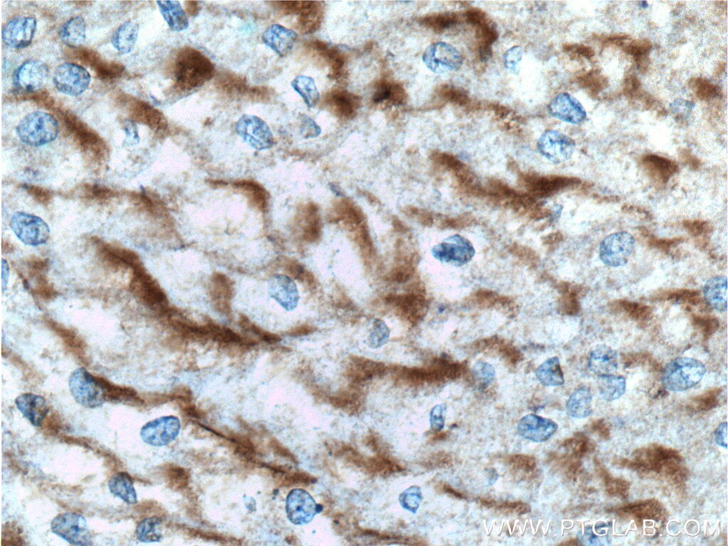 VEGF Antibody 19003-1-AP | Proteintech