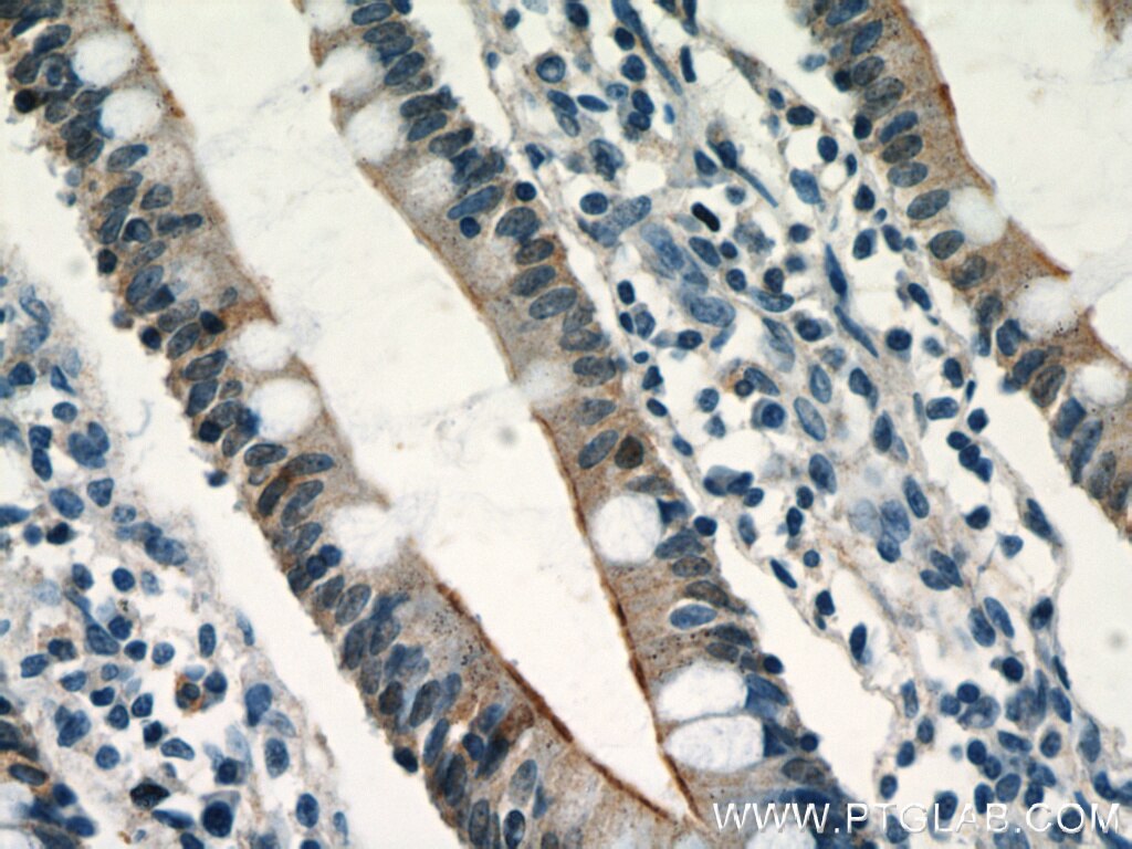 Villin antibody (16488-1-AP) | Proteintech