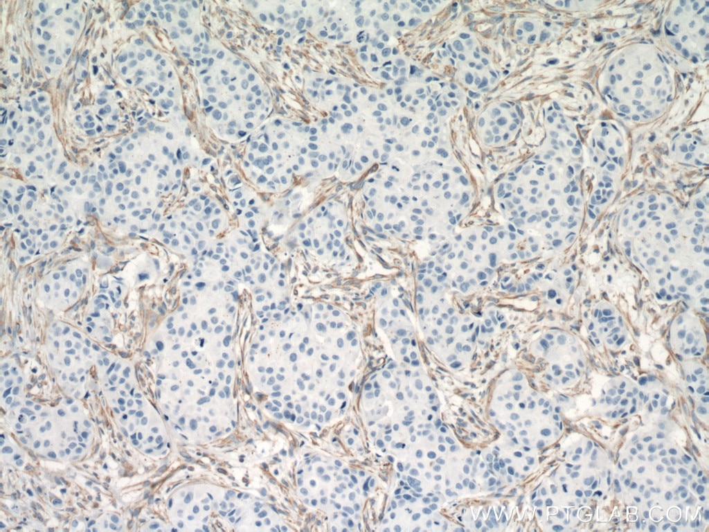 Vimentin Antibody 10366-1-AP | Proteintech
