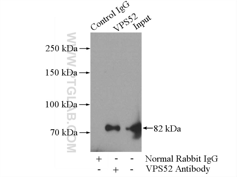 VPS52 antibody (11662-2-AP) | Proteintech