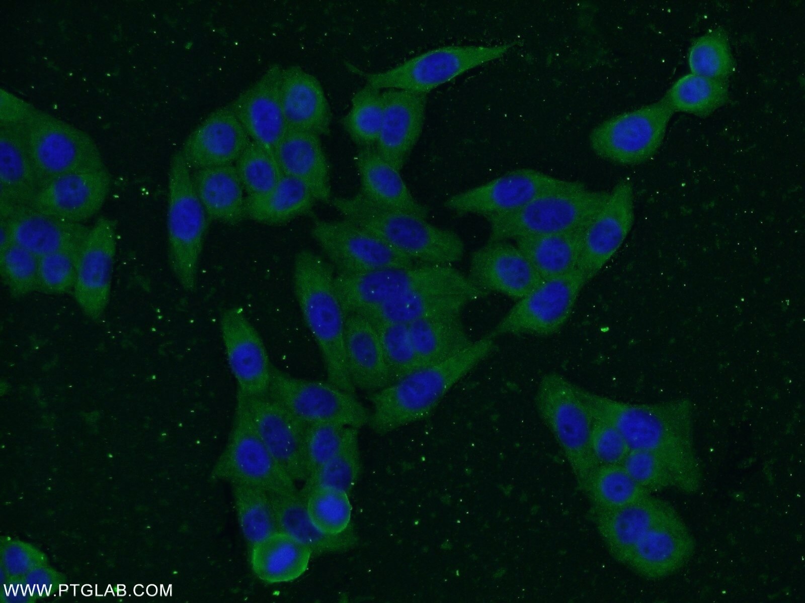 Vimentin Antibody 60330-1-Ig | Proteintech