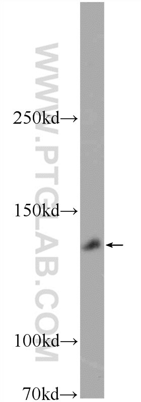 WWC2 Antibody 24750-1-AP | Proteintech