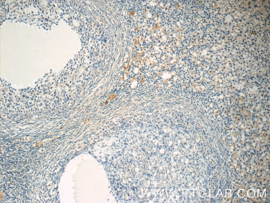 ZER1 antibody (16647-1-AP) | Proteintech