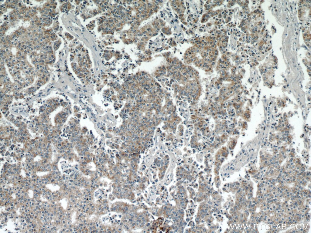 ZP3 Antibody 21279-1-AP | Proteintech