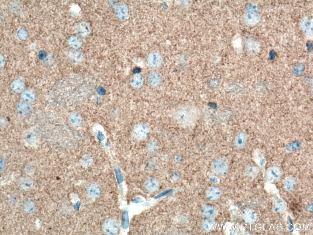 Alpha Synuclein antibody (66412-1-Ig) | Proteintech
