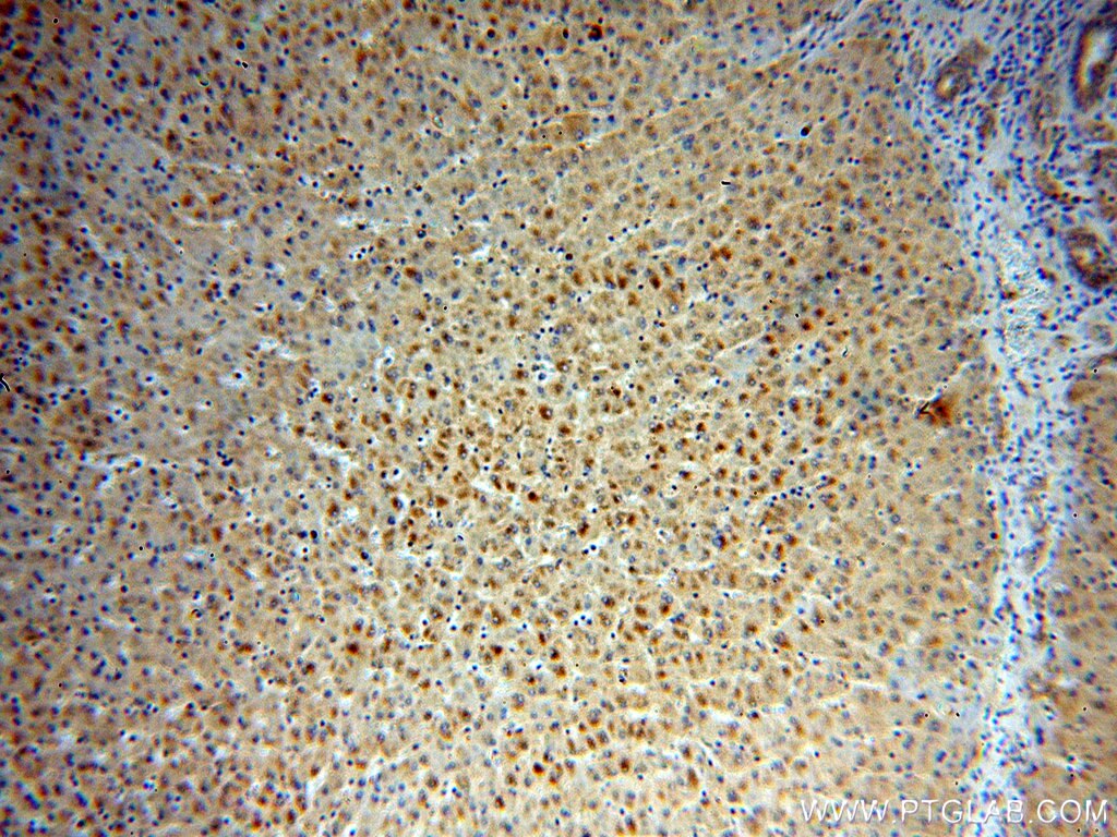 fetuin-B Antibody 18052-1-AP | Proteintech