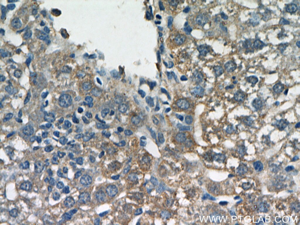 fetuin-B Antibody 18052-1-AP | Proteintech