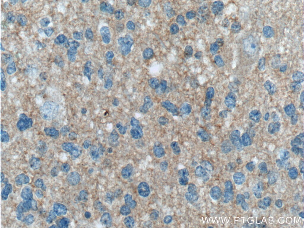 p38 MAPK Antibody 66234-1-Ig | Proteintech