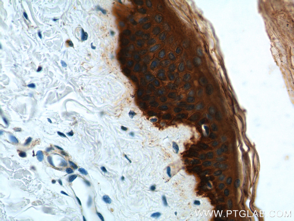 pan-keratin Antibody 26411-1-AP | Proteintech