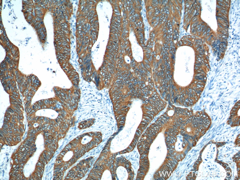 pan-keratin Antibody 26411-1-AP | Proteintech