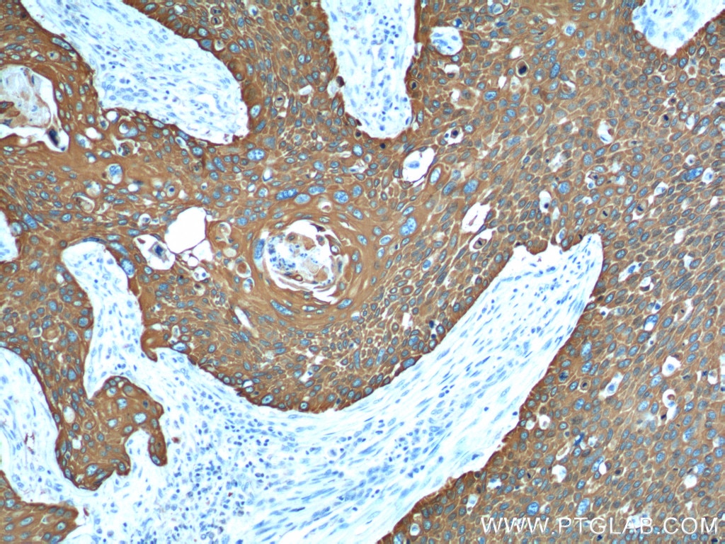 pan-keratin Antibody 26411-1-AP | Proteintech