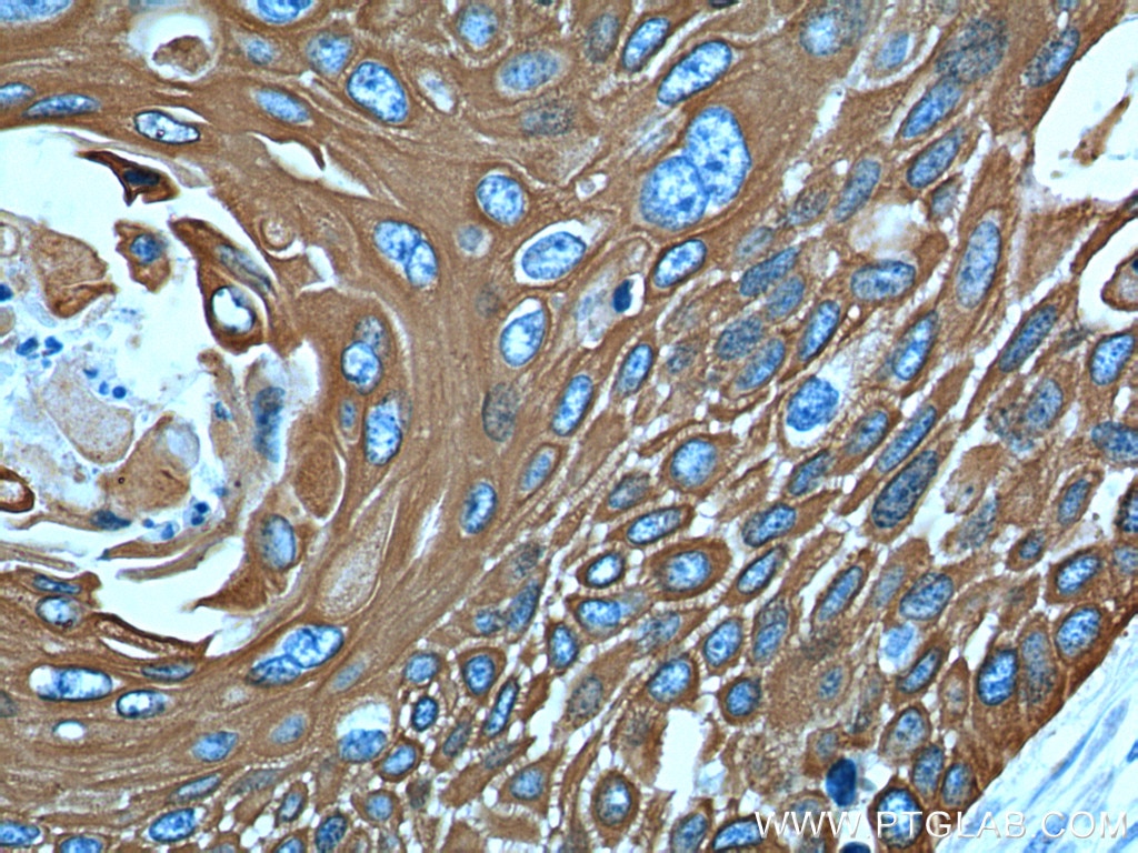 pan-keratin Antibody 26411-1-AP | Proteintech