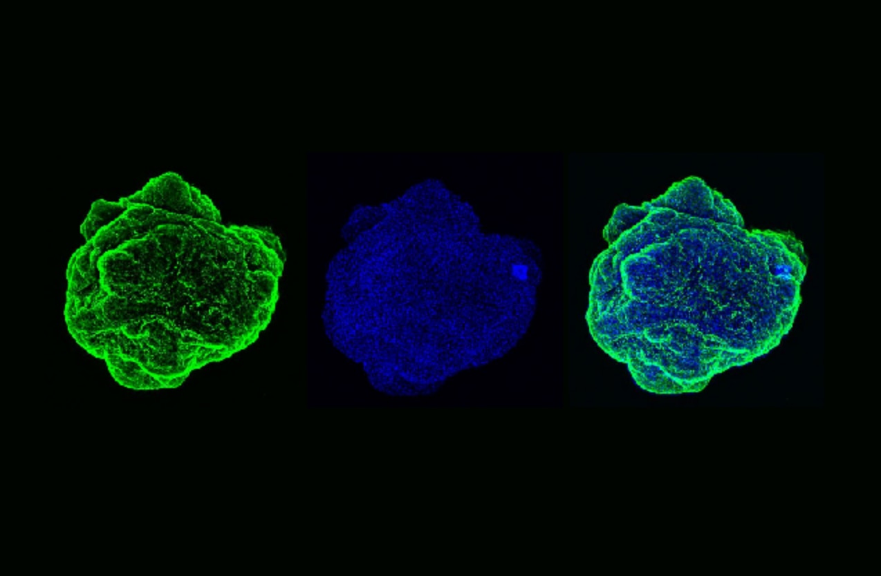 Cardiac Organoids in Research | Proteintech Group