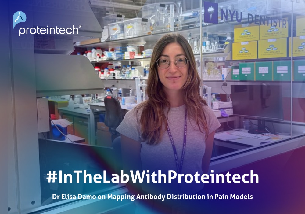 Research Grant Stories: Dr Elisa Damo on Mapping Antibody Distribution ...