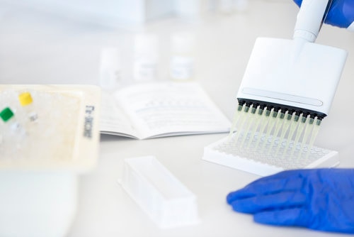 How To Optimize Your ELISA Experiments | Proteintech Group
