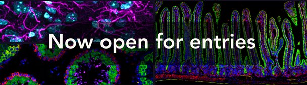 Microscopy Image Competition | Proteintech Group
