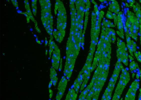 Cardiovascular Research | Proteintech Group Cardiovascular Research | Proteintech Group