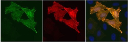 New anti-mNeonGreen antibody & Nano-Trap for Immunofluorescence ...