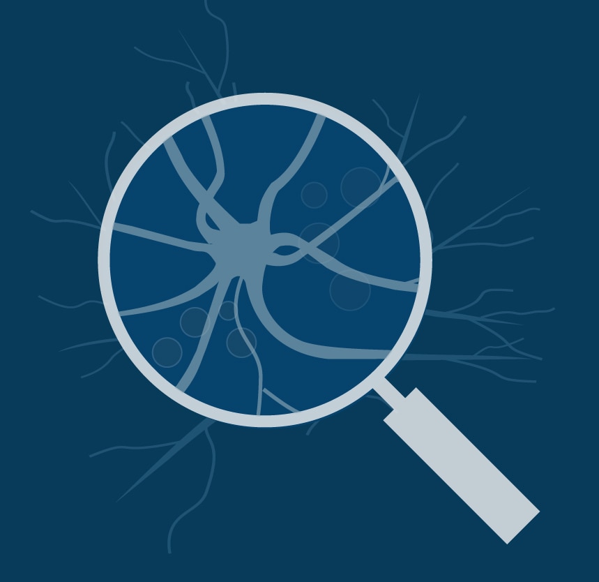 How to Identify Activated Microglia | Proteintech Group