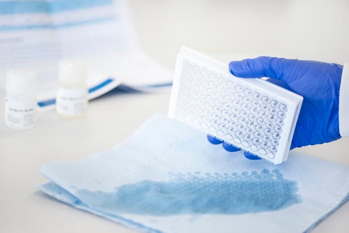 ELISA Kits for SARS-COV-2 / COVID-19 | Proteintech Group