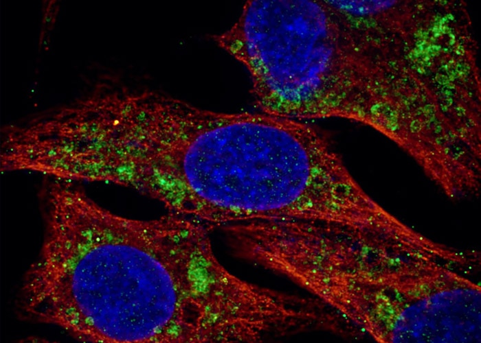 Autophagy: LC3 & GABARAP Antibodies | Proteintech Group