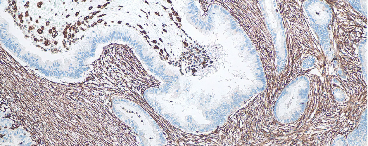 IHC Workshop: The Basics and Beyond | Proteintech Group