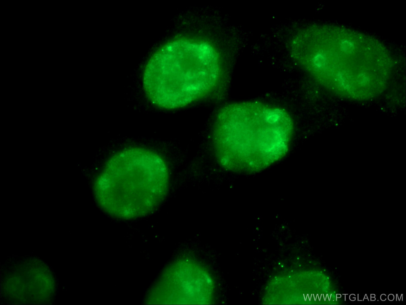 Proliferating cells: BrdU and Ki-67 cellular markers | Proteintech Group