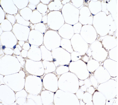 Brown Adipose Tissue Product Feature | Proteintech Group