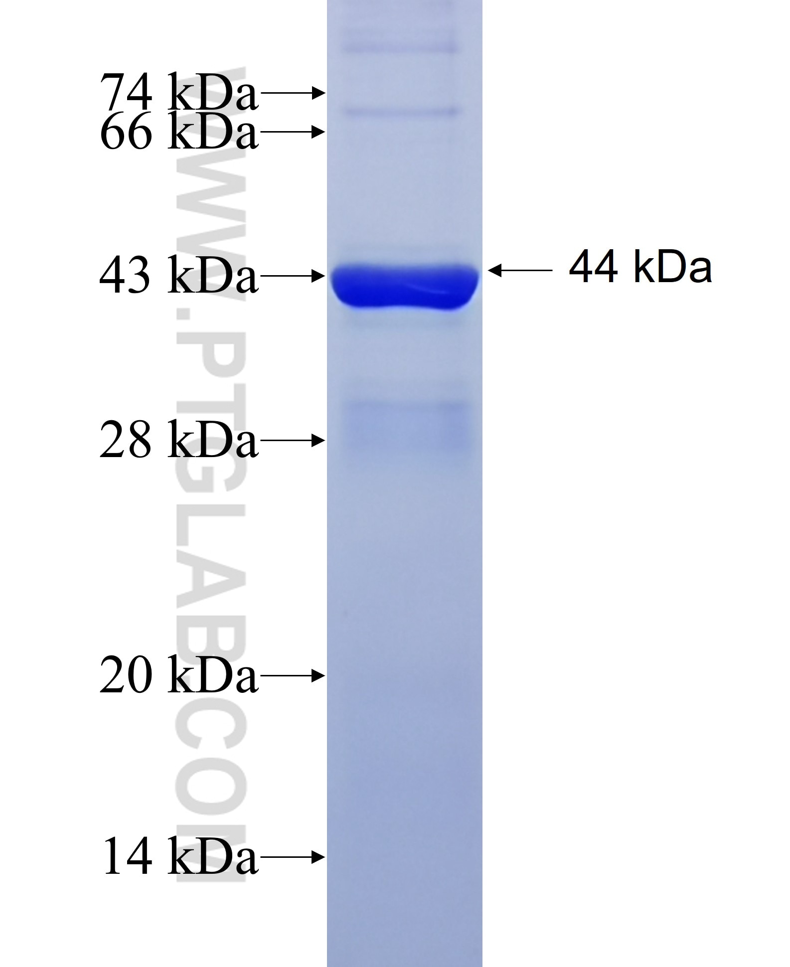 CKAP4 Fusion Protein Ag10022 | Proteintech