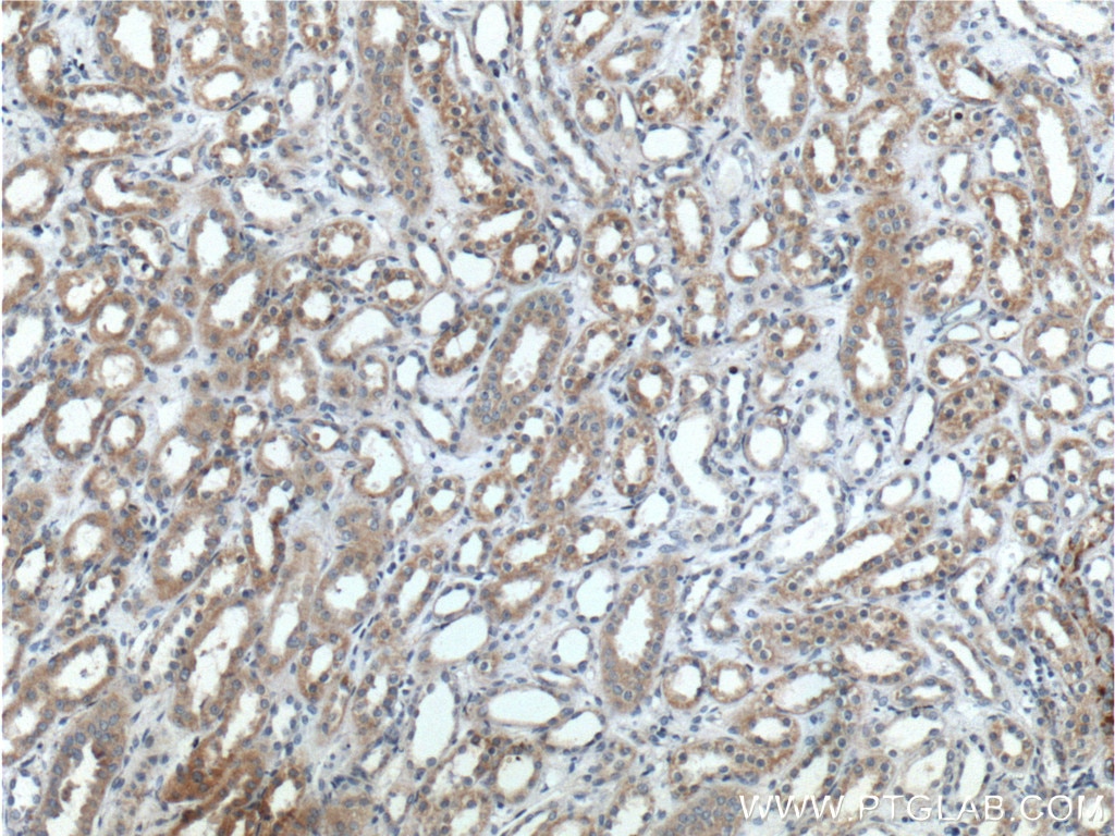 Beta ENaC antibody (14134-1-AP) | Proteintech